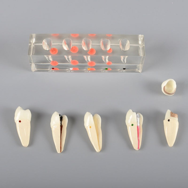 W4007-2 Dental Endodontic Treatment Model – Dr Wong Anatomy