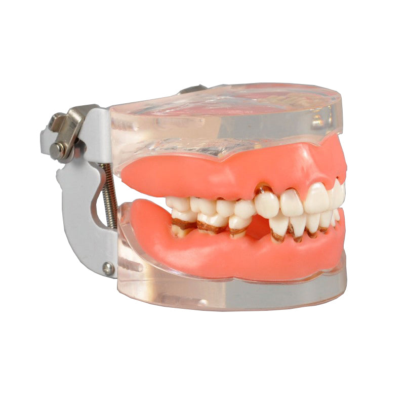 W4017 Dental Periodontal Model for Demonstration