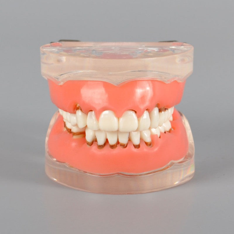 W4017 Dental Periodontal Model for Demonstration