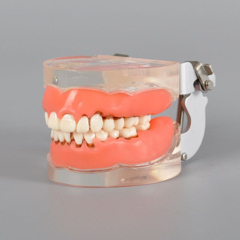 W4017 Dental Periodontal Model for Demonstration