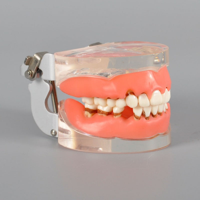 W4017 Dental Periodontal Model for Demonstration