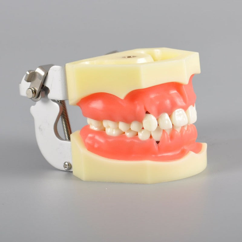 W4023 Dental Periodontal Model with Calculus and Gingivitis