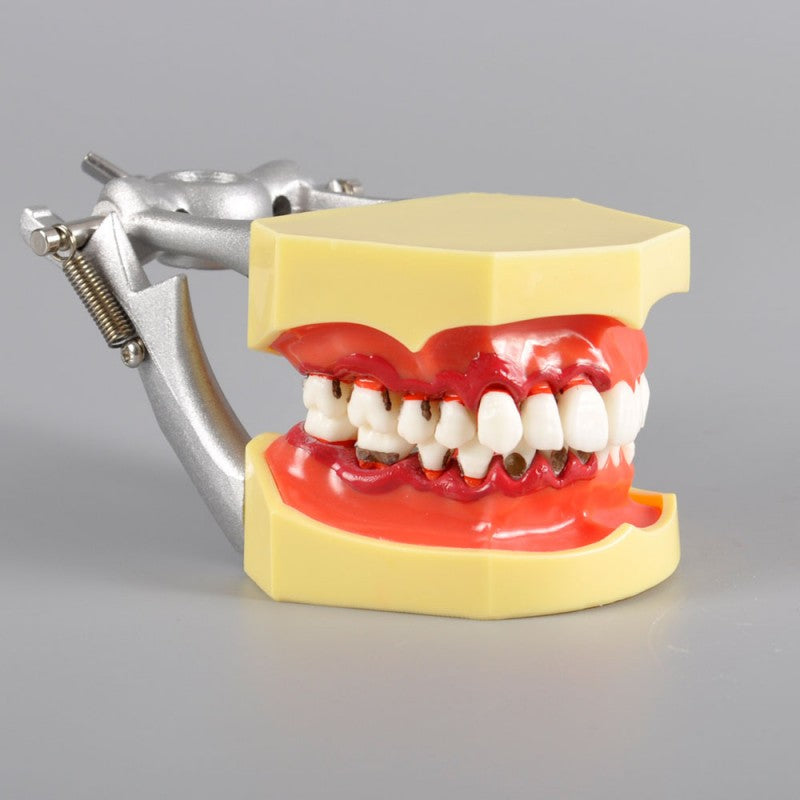 W4025 Dental Periodontal Model for Demonstration