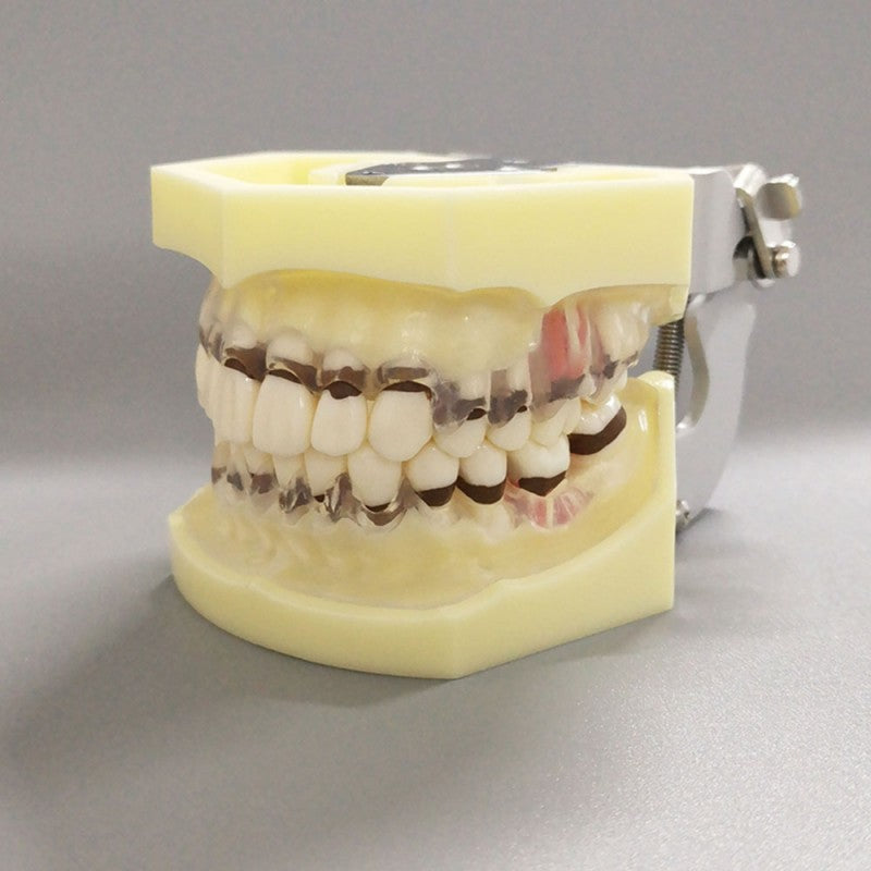 W4028 Dental Periodontal Model with Transparent Gum