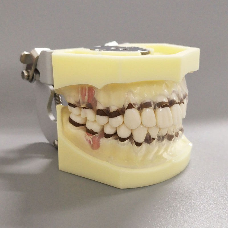 W4028 Dental Periodontal Model with Transparent Gum