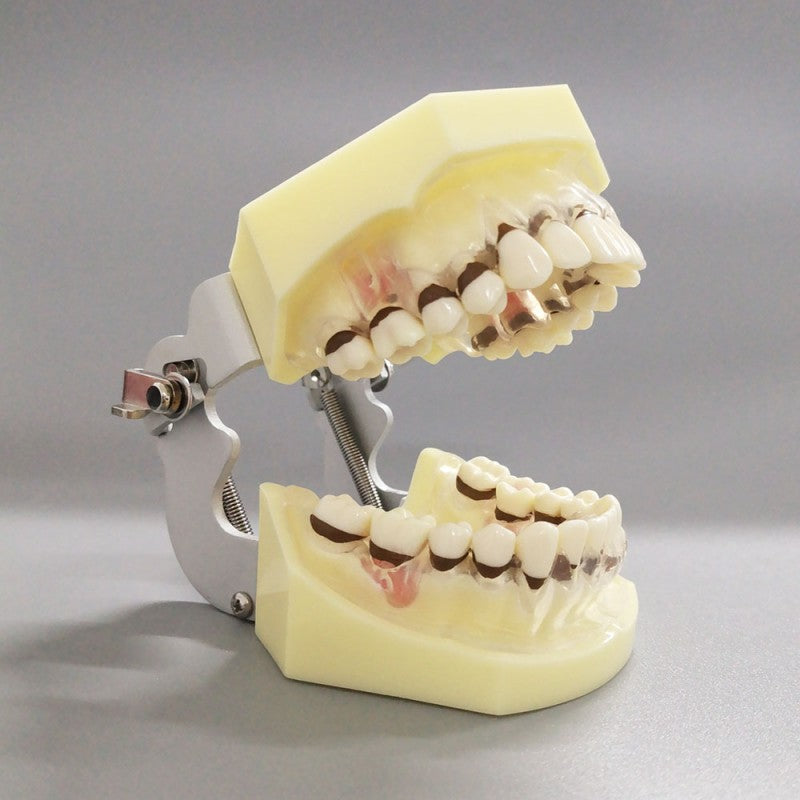 W4028 Dental Periodontal Model with Transparent Gum