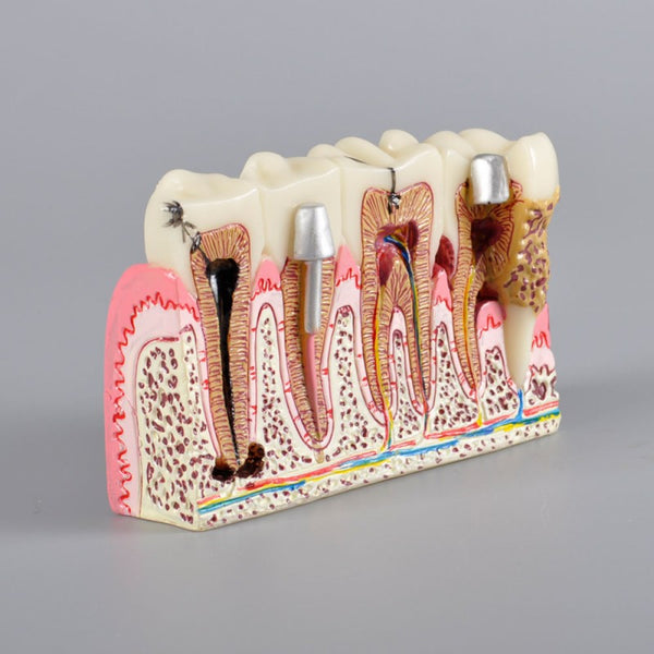 W4029 Dental Pathology Model with Kinds of Cases