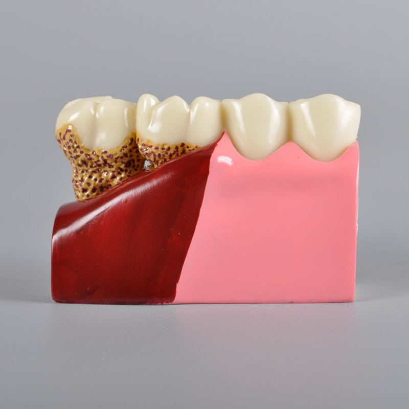 W4029 Dental Pathology Model with Kinds of Cases