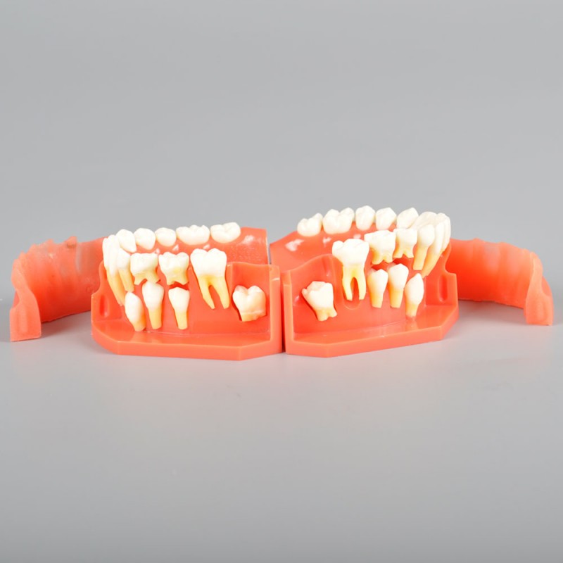 W7013 Pediatric Teeth Development Model Age 9-12