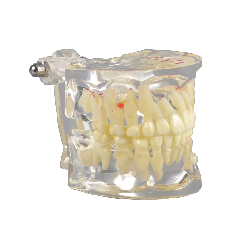 W7016 Pediatric Dental Model - 7 Years Old