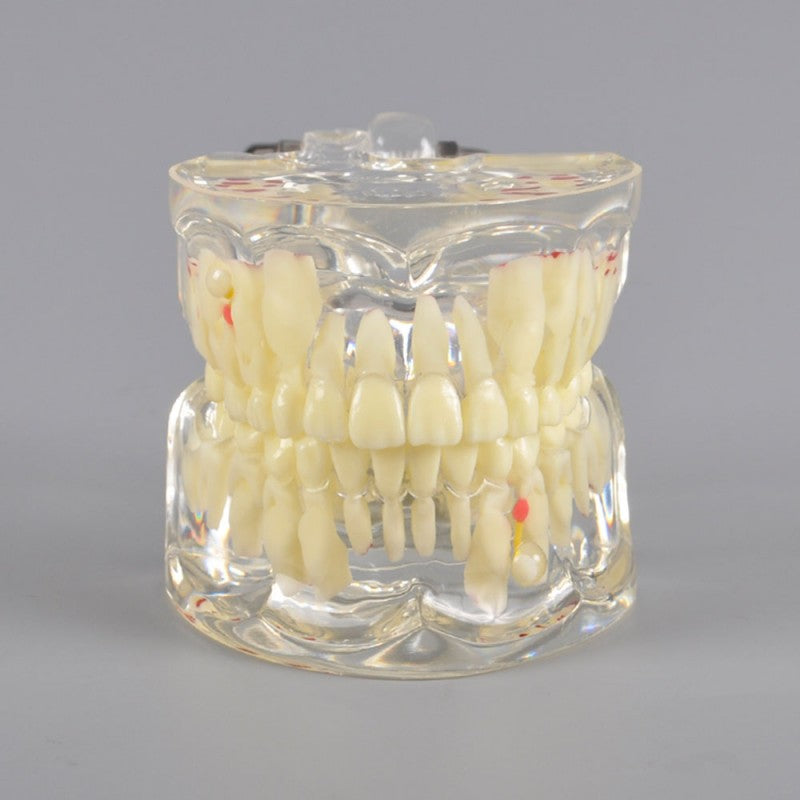 W7016 Pediatric Dental Model - 7 Years Old