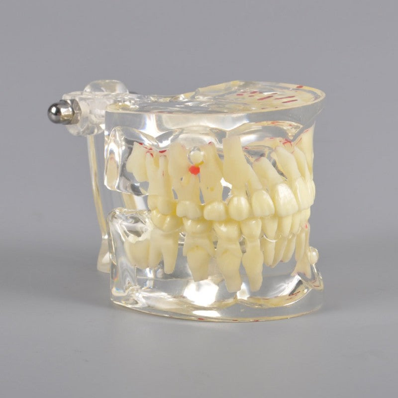 W7016 Pediatric Dental Model - 7 Years Old
