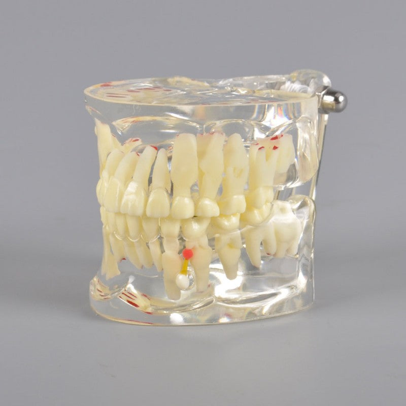 W7016 Pediatric Dental Model - 7 Years Old