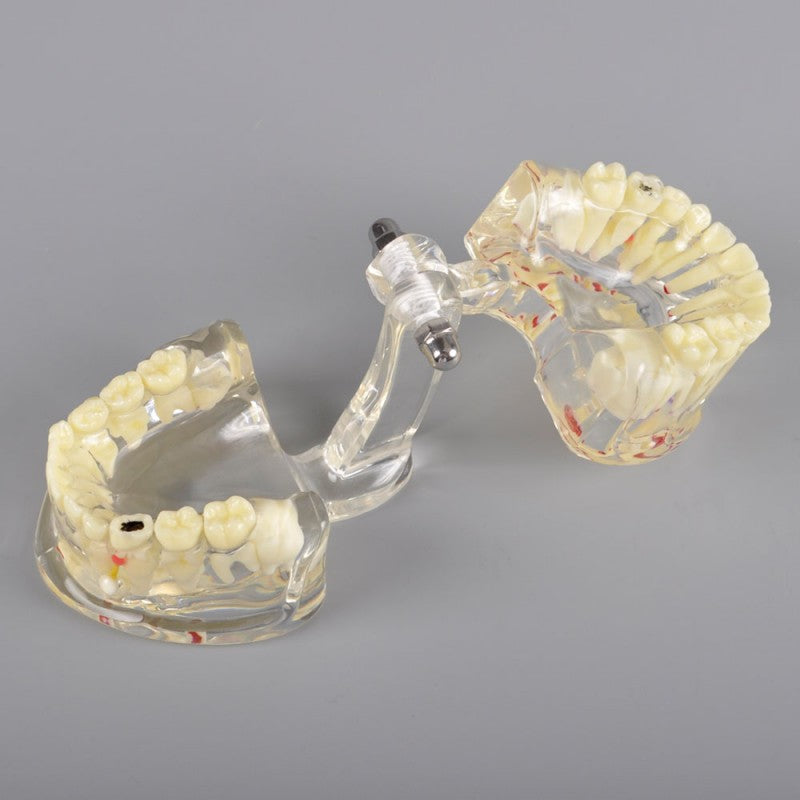 W7016 Pediatric Dental Model - 7 Years Old