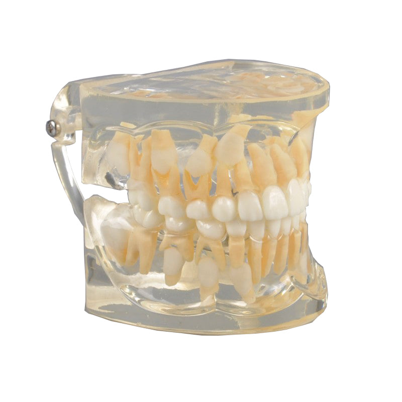 W7018 Pediatric Dental Model - 9 Years Old