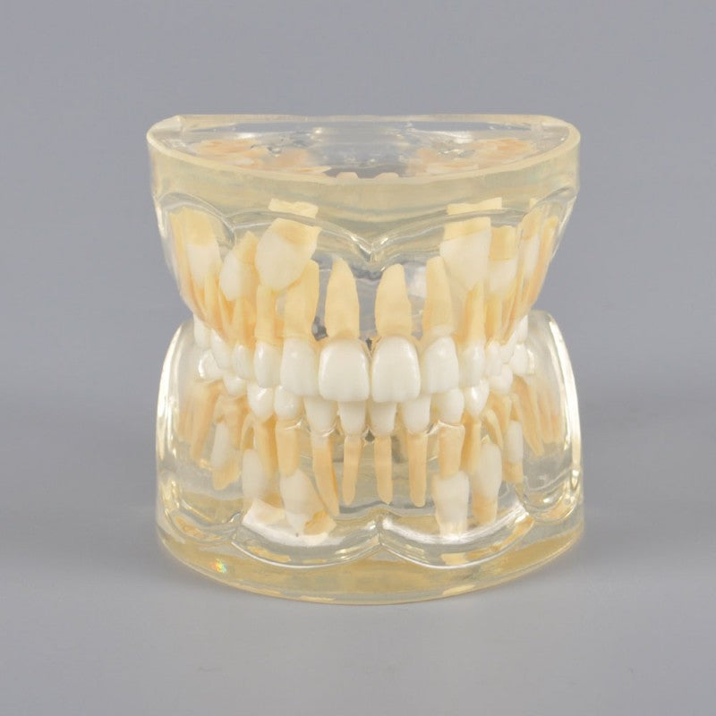 W7018 Pediatric Dental Model - 9 Years Old