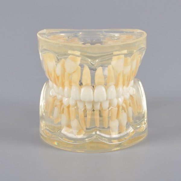 W7018 Pediatric Dental Model - 9 Years Old