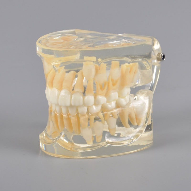 W7018 Pediatric Dental Model - 9 Years Old