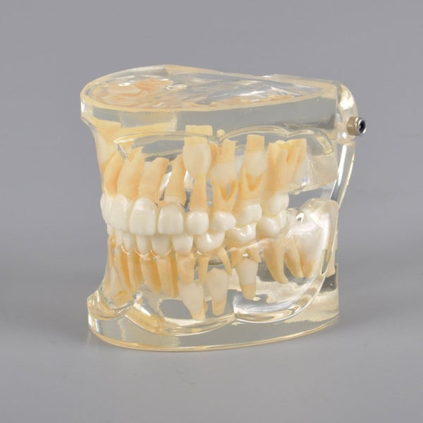 W7018 Pediatric Dental Model - 9 Years Old